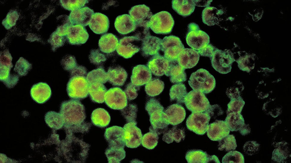 Brain-Eating Amoebas a Warm Weather Side Effect | The Weather Channel