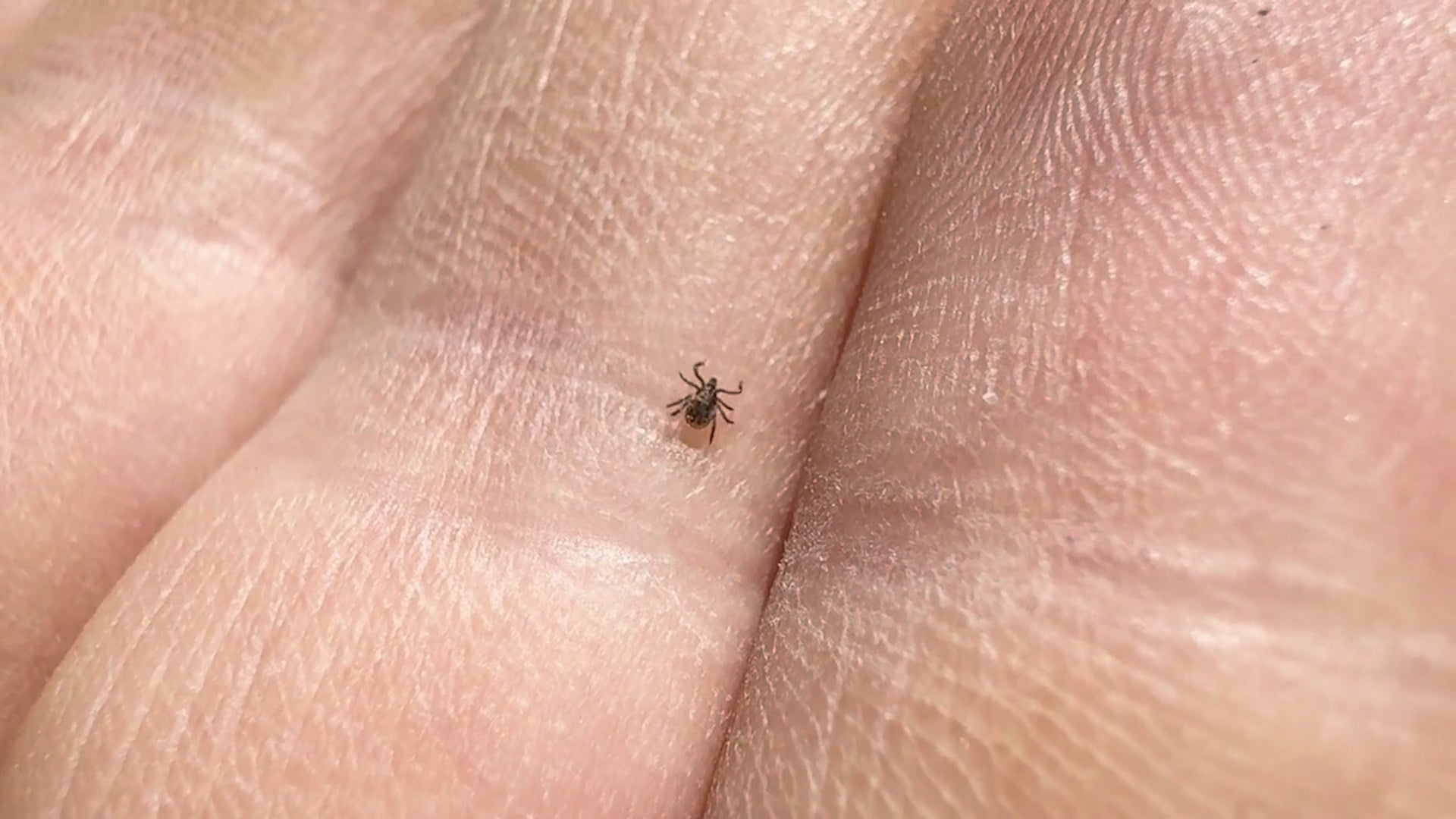 Ticks Are Causing Allergy Increase - Videos from The Weather Channel