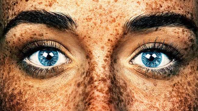 Photographer Captures the Beauty of Freckles in All Their Glory | The ...