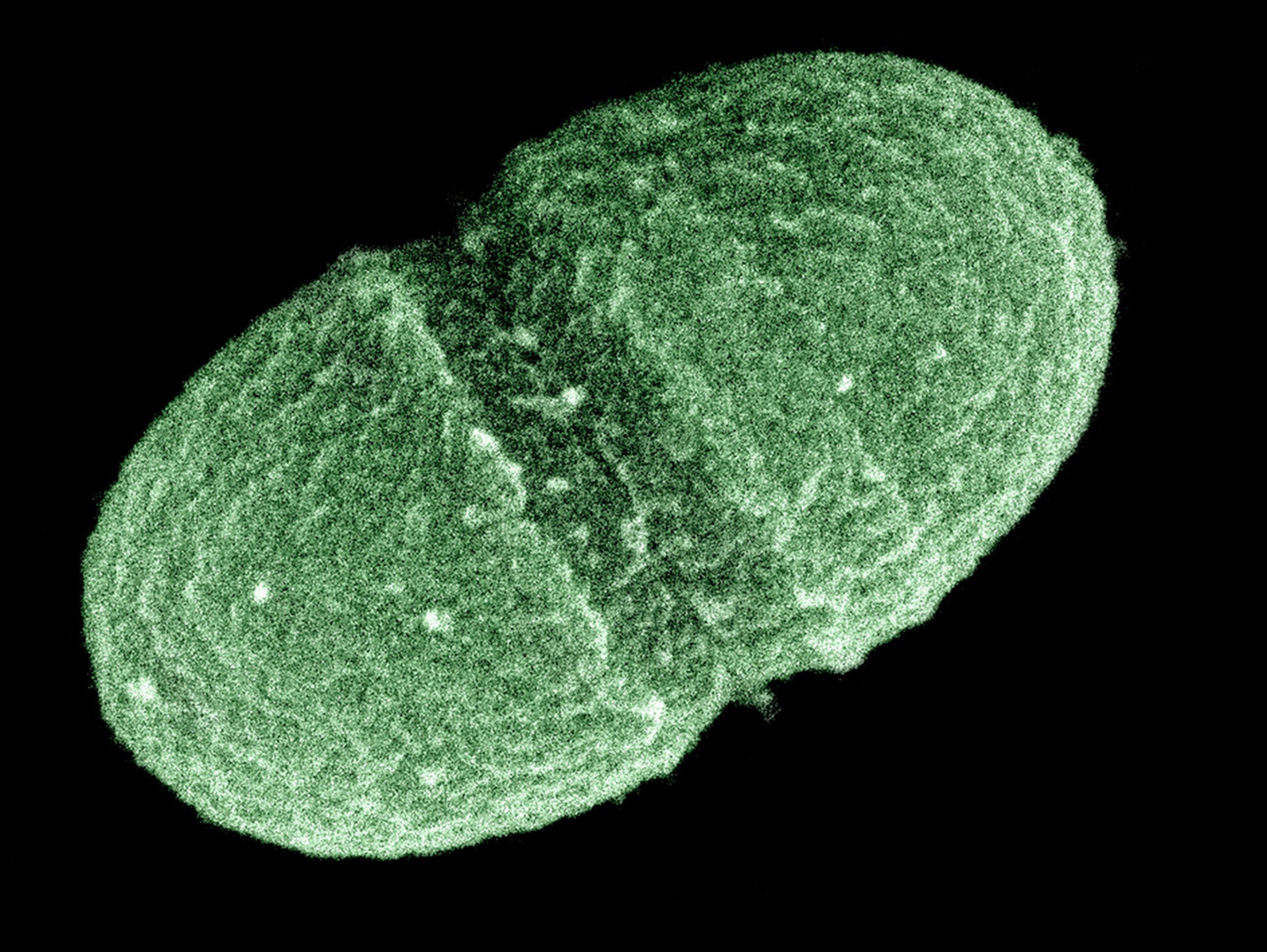 What's in Your Gut? These Projects Aim to Find Out | Weather.com