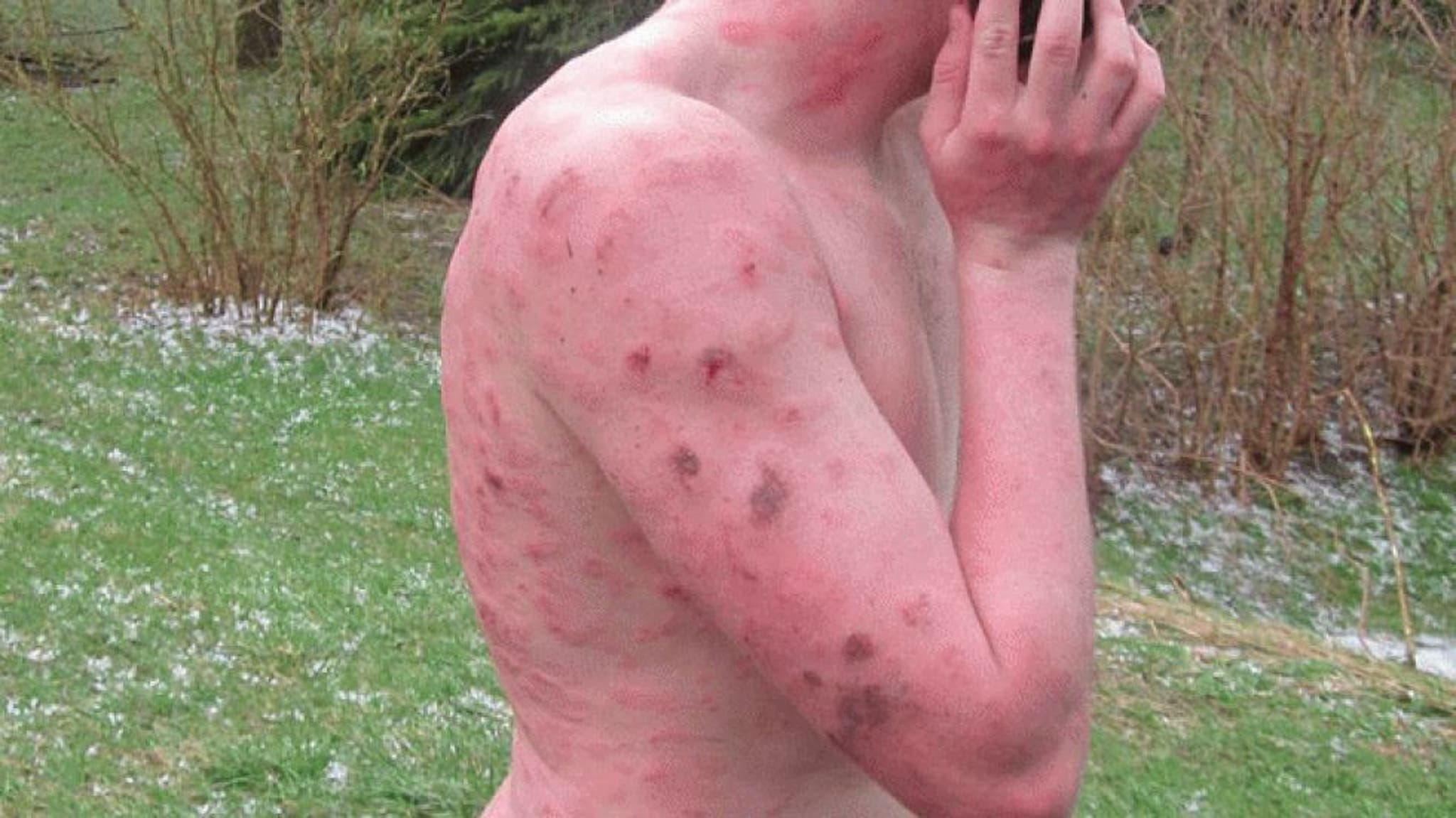 Why Large Hail Is an Underrated Danger and Poses a Major Threat to ...