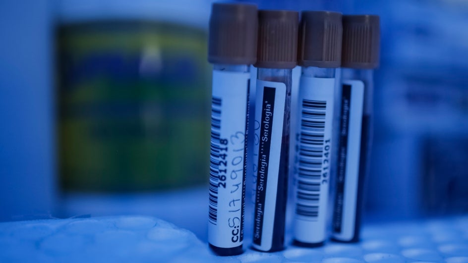 Australian Researchers Develop Blood Test Technique To Detect COVID 19 Australian Researchers Develop Blood Test Technique To Detect COVID 19