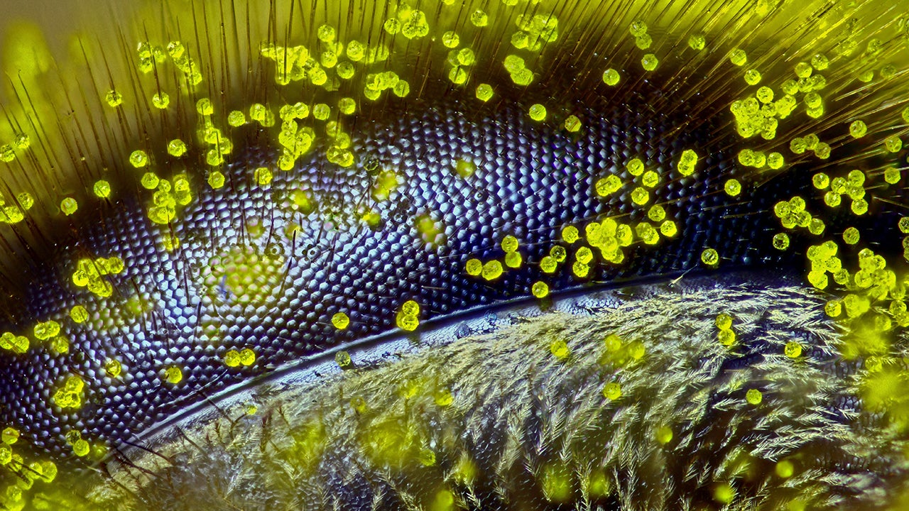 The Winning Photomicrographs of 2015 (PHOTOS) | The Weather Channel