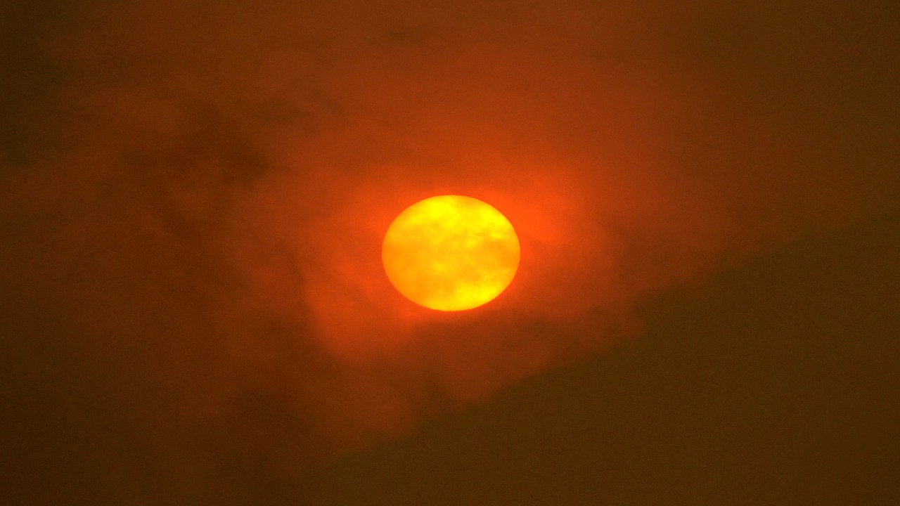 How to treat sunburns fast: Sun safety tips amid amber heatwave health ...