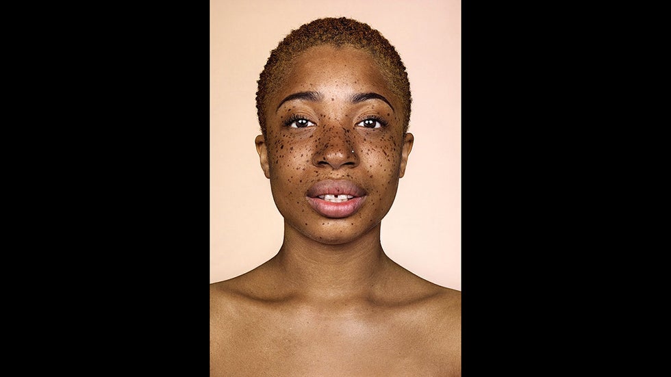 Photographer Captures the Beauty of Freckles in All Their Glory | The ...