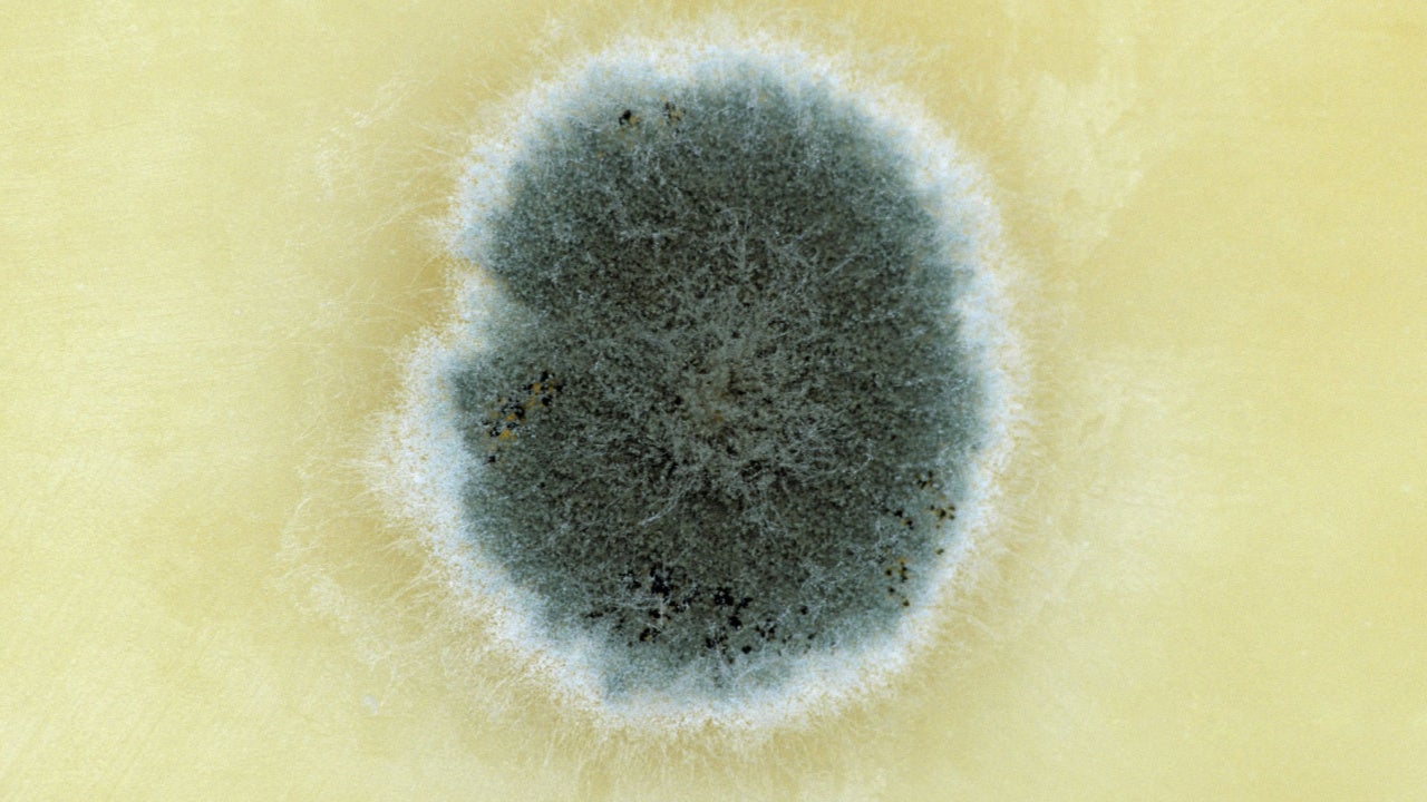 Mold Under Microscope